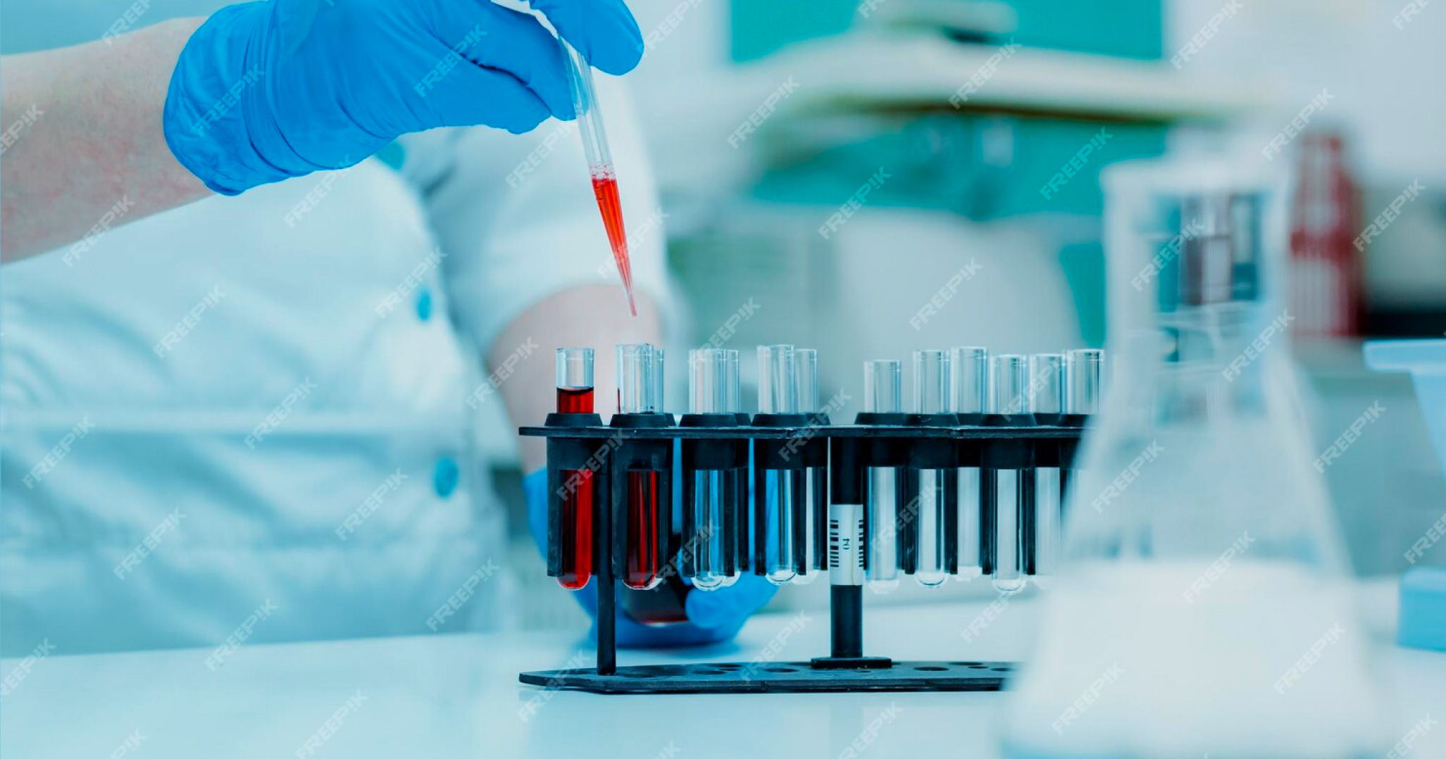 Biotechnology Startup Launches Blood Test For Alzheimer s Disease Risk biotechnology-startup-launches-blood-test-for-alzheimer-s-disease-risk